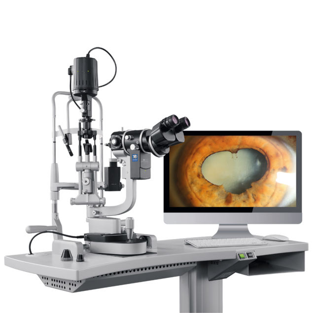 Slit lamp imaging